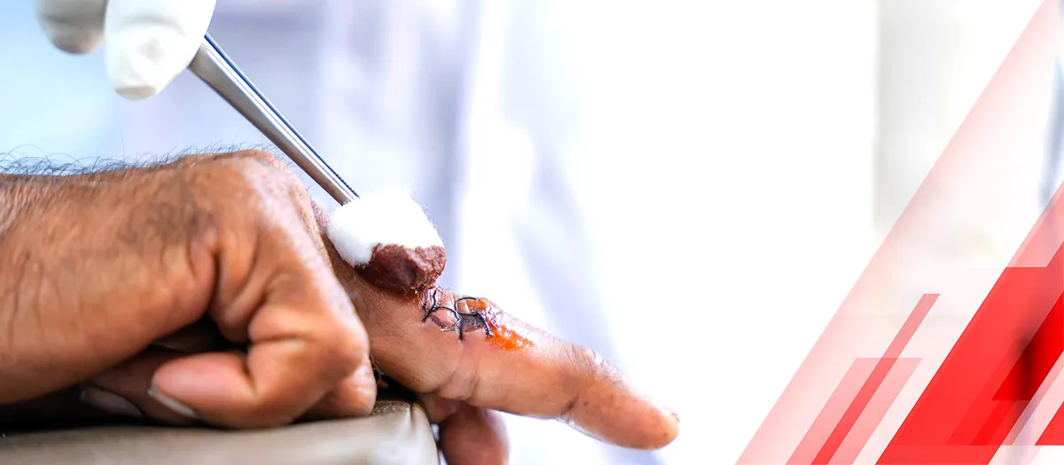 Top 10 Global Leaders in the Wound Care Market (2025 Edition)